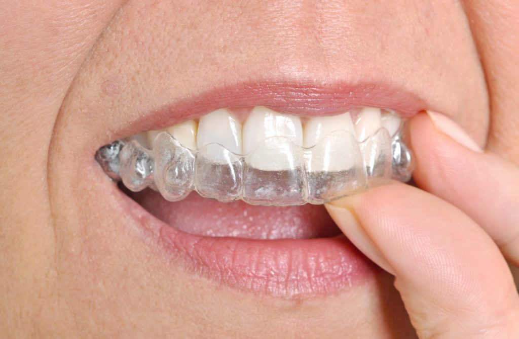 Invisalign - Weymouth, MA - Comfort Dental