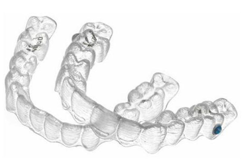Invisalign - Advanced Orthodontics - Advanced Dental